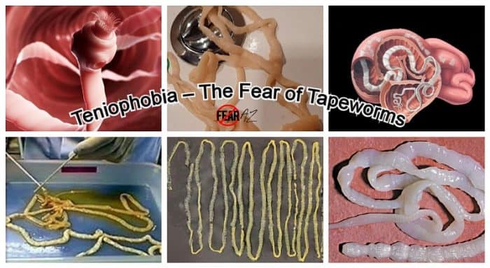Taeniophobia/Teniophobia - Fear of Tapeworms