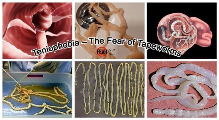Taeniophobia/Teniophobia - Fear of Tapeworms